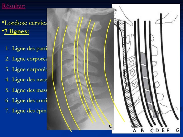 Technique radiologique rachis cervical
