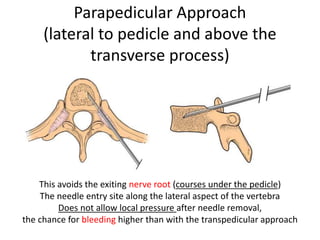 Vertebroplasty and Kyphoplasty Techniques | PPT