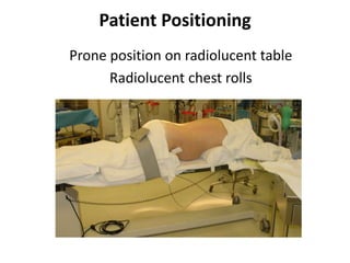 Vertebroplasty and Kyphoplasty Techniques | PPT