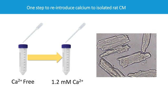 Techniques and Best Practices for Cardiomyocyte Isolation