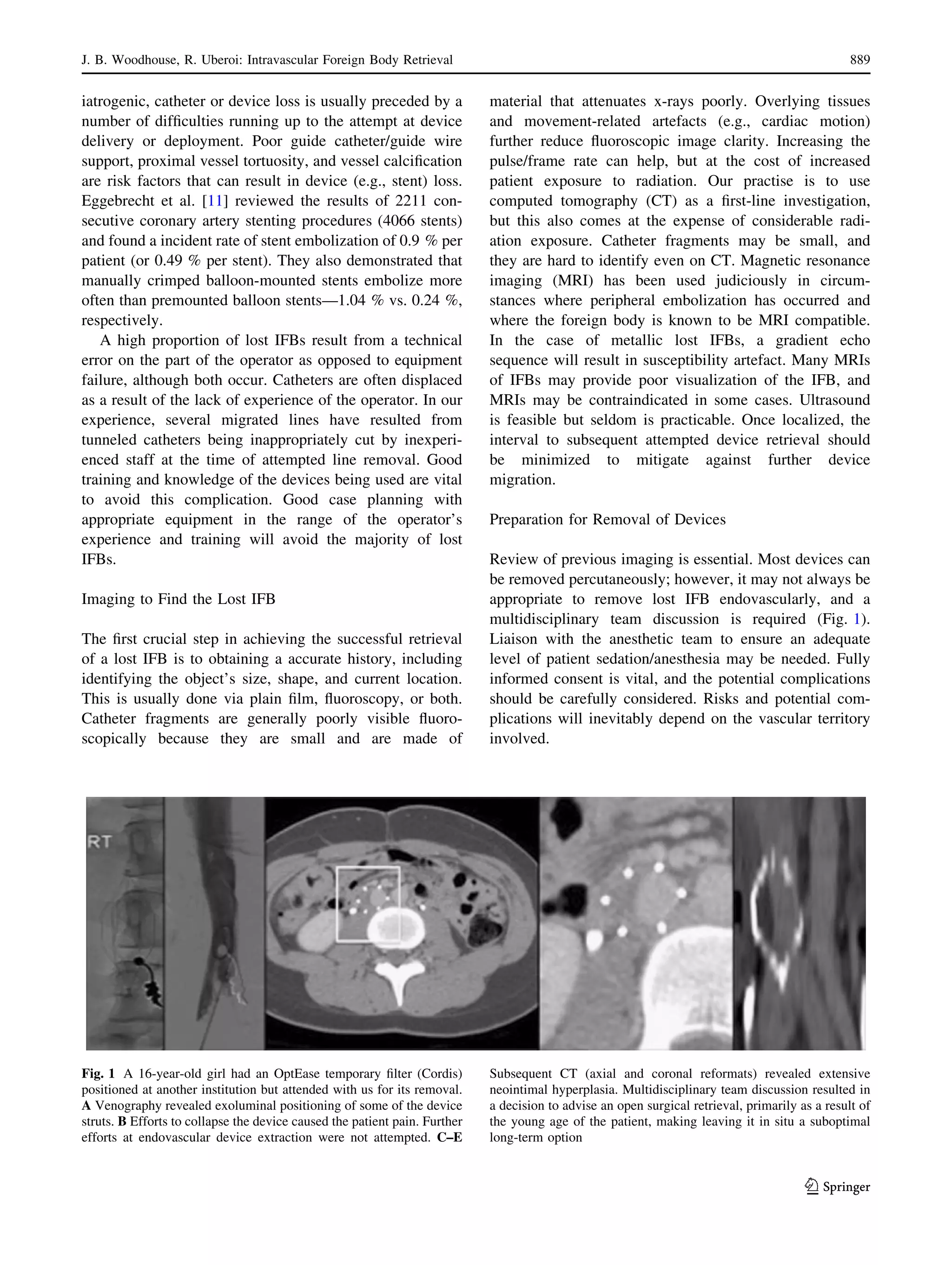 Techniques for intravascular foreign body retrieval | PDF