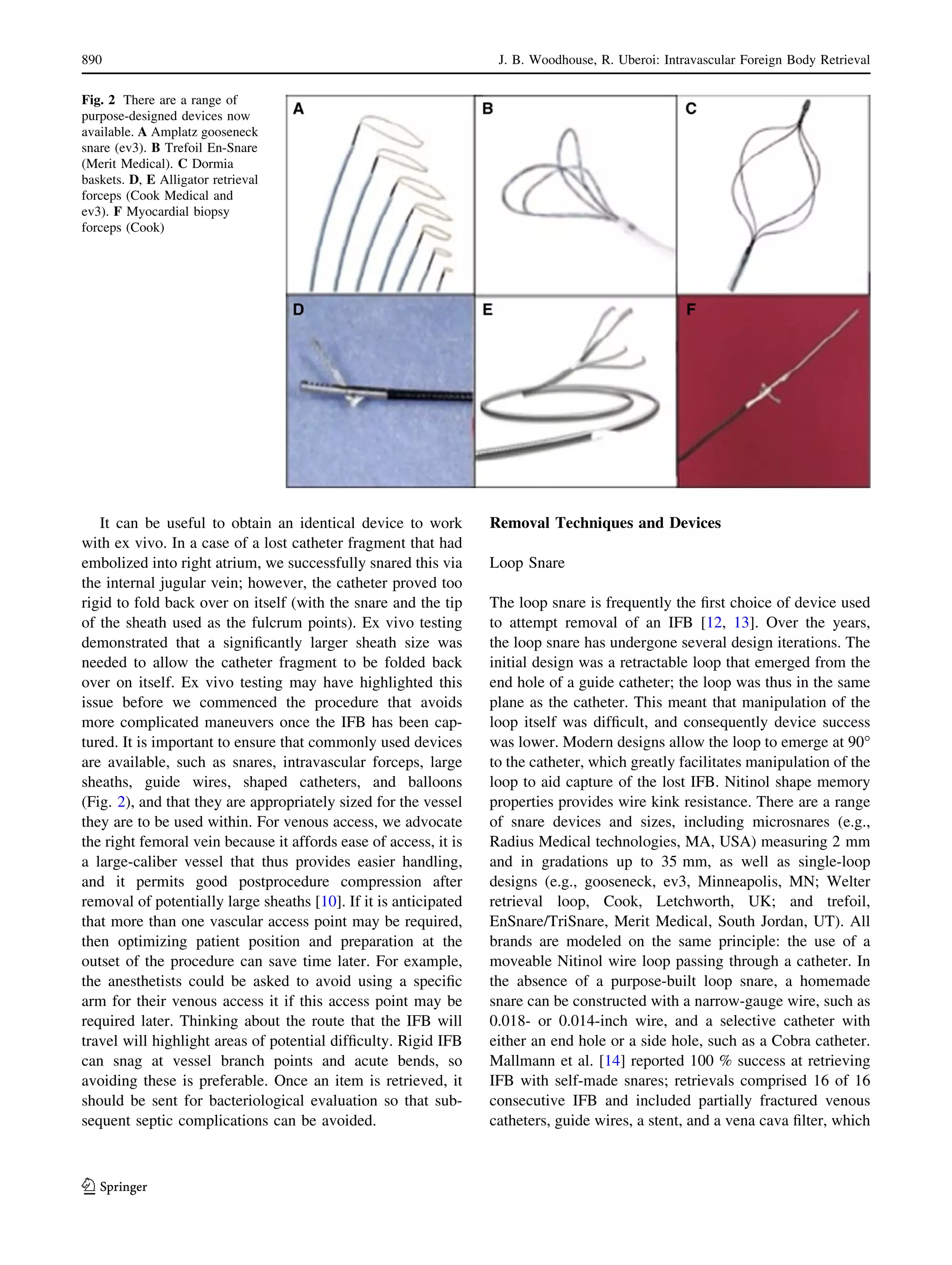 Techniques for intravascular foreign body retrieval | PDF