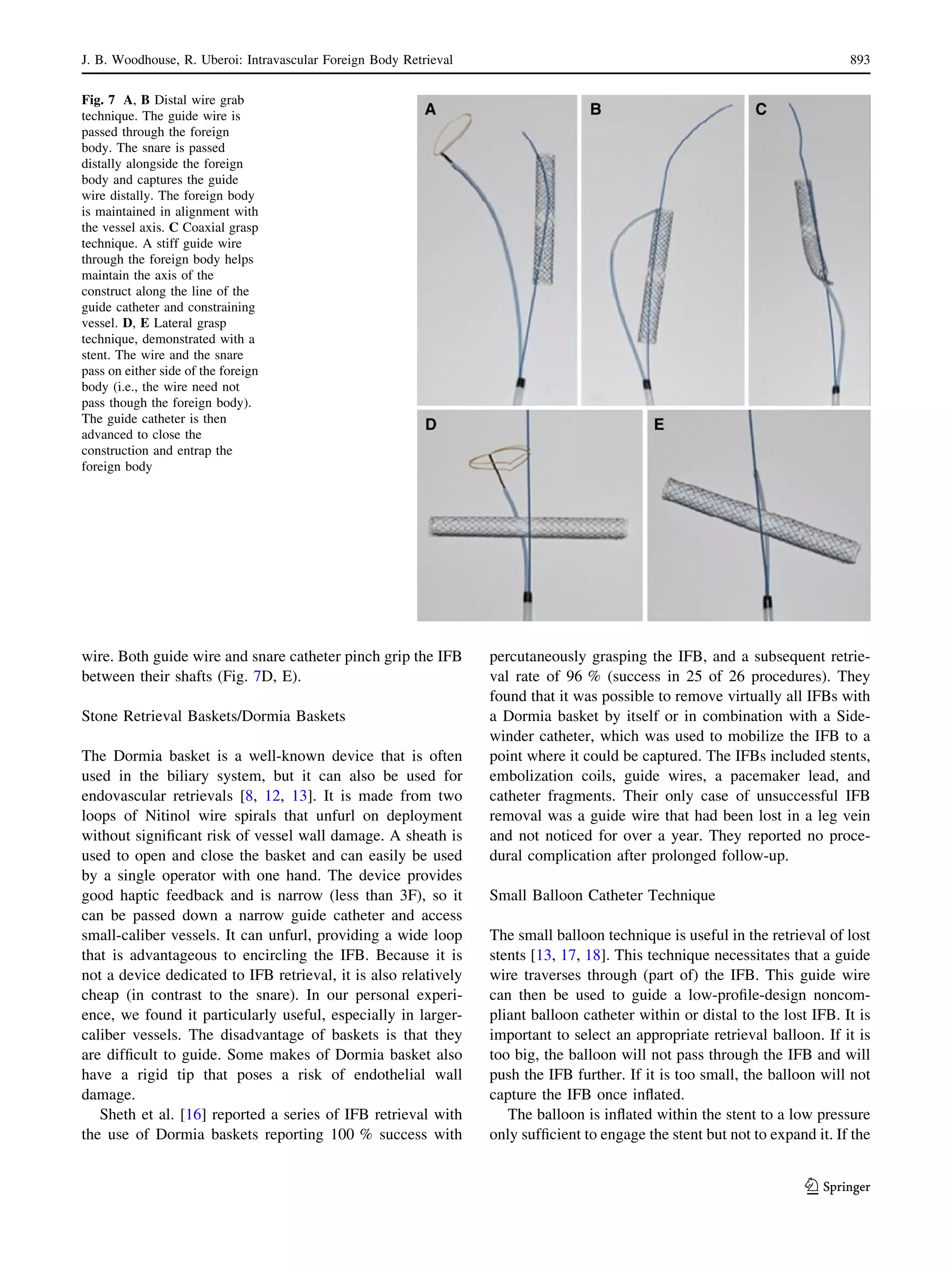 Techniques for intravascular foreign body retrieval | PDF