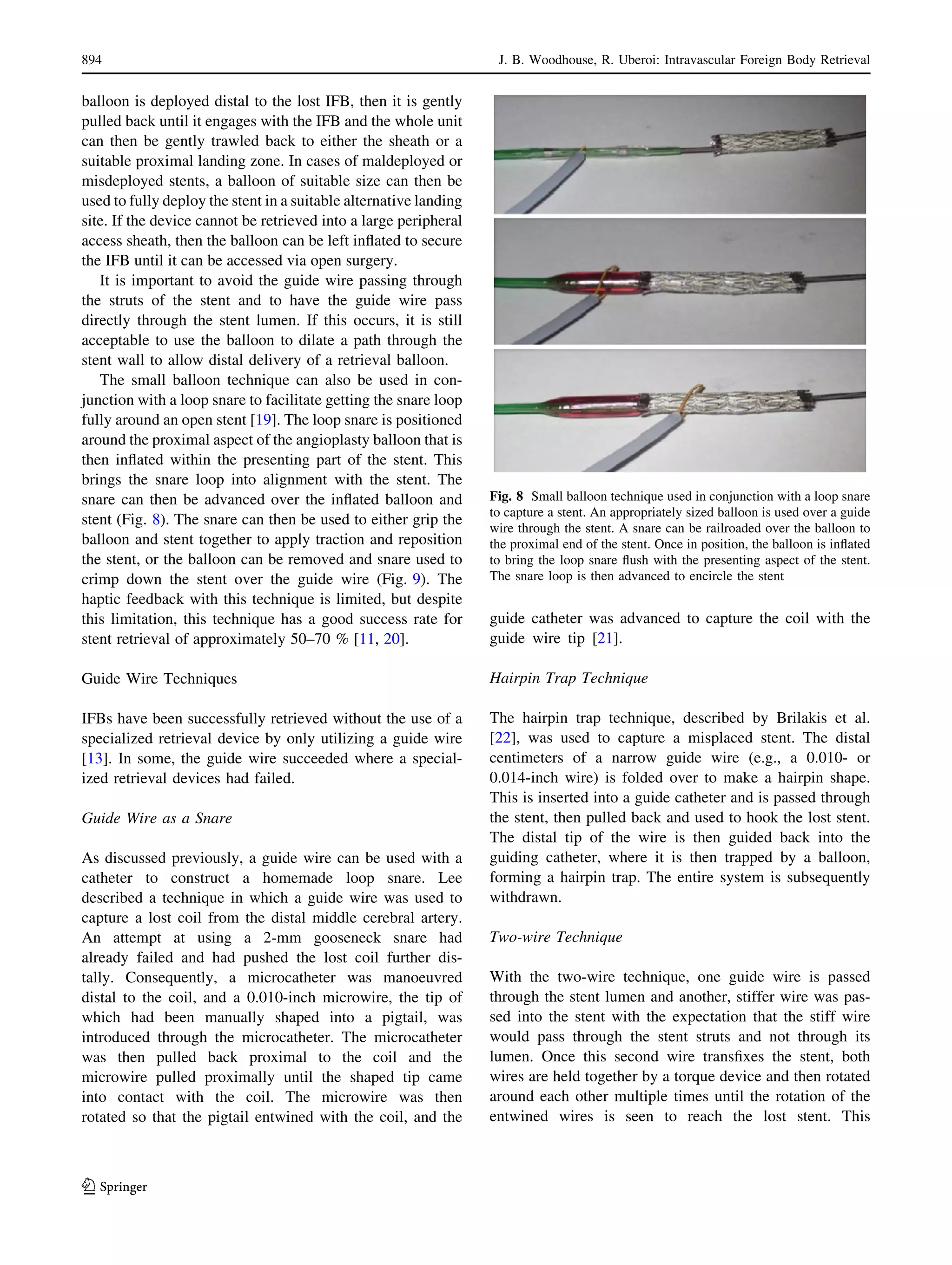 Techniques for intravascular foreign body retrieval | PDF