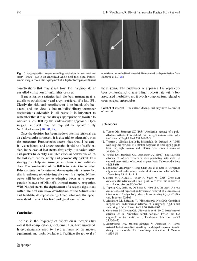 Techniques for intravascular foreign body retrieval | PDF