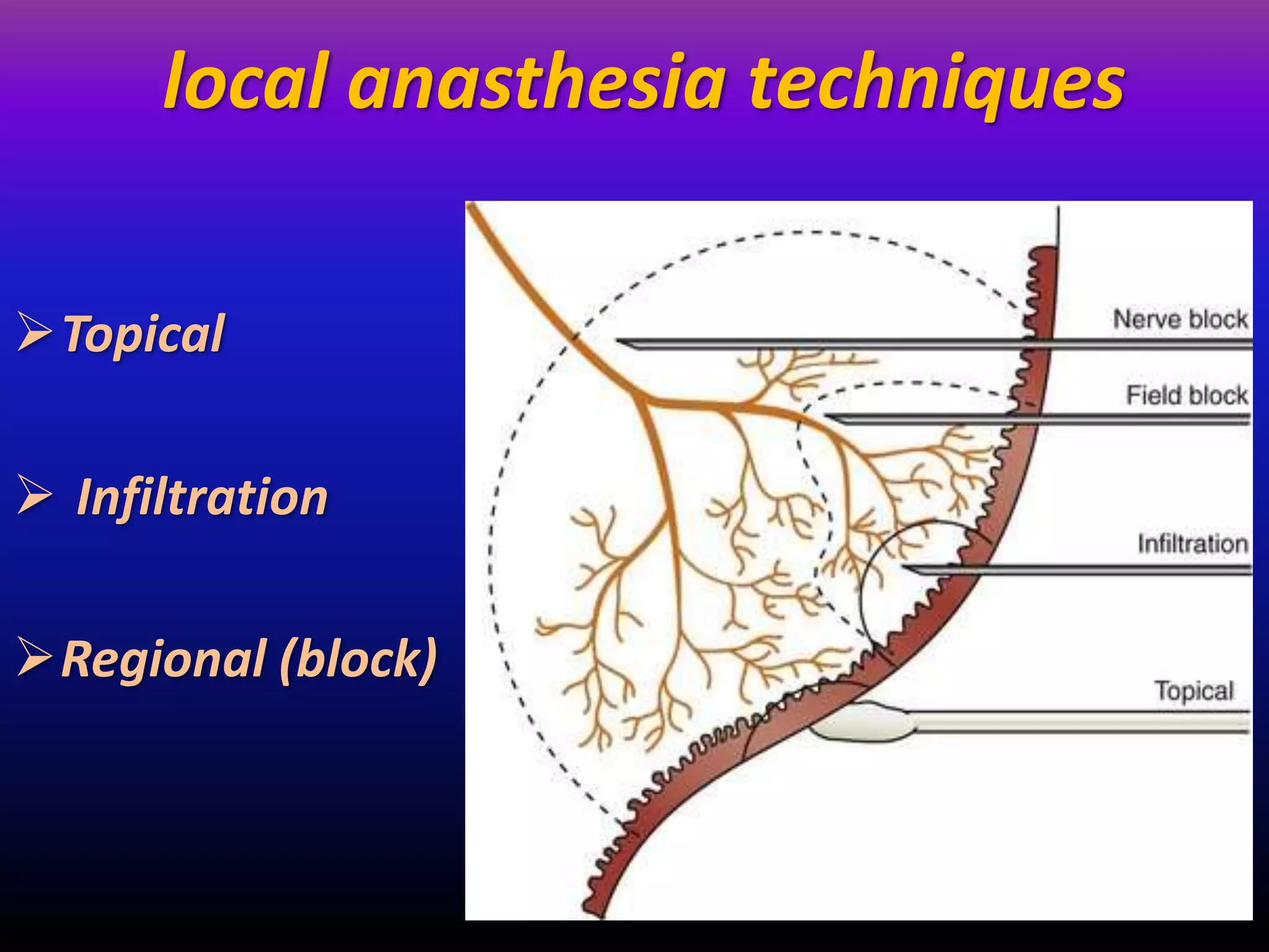 Techniques for local anasthesia in dentistry | PPSX