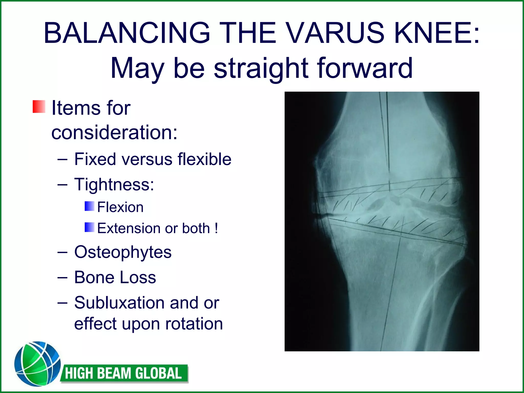 Techniques in primary total knee arthroplasty | PPT