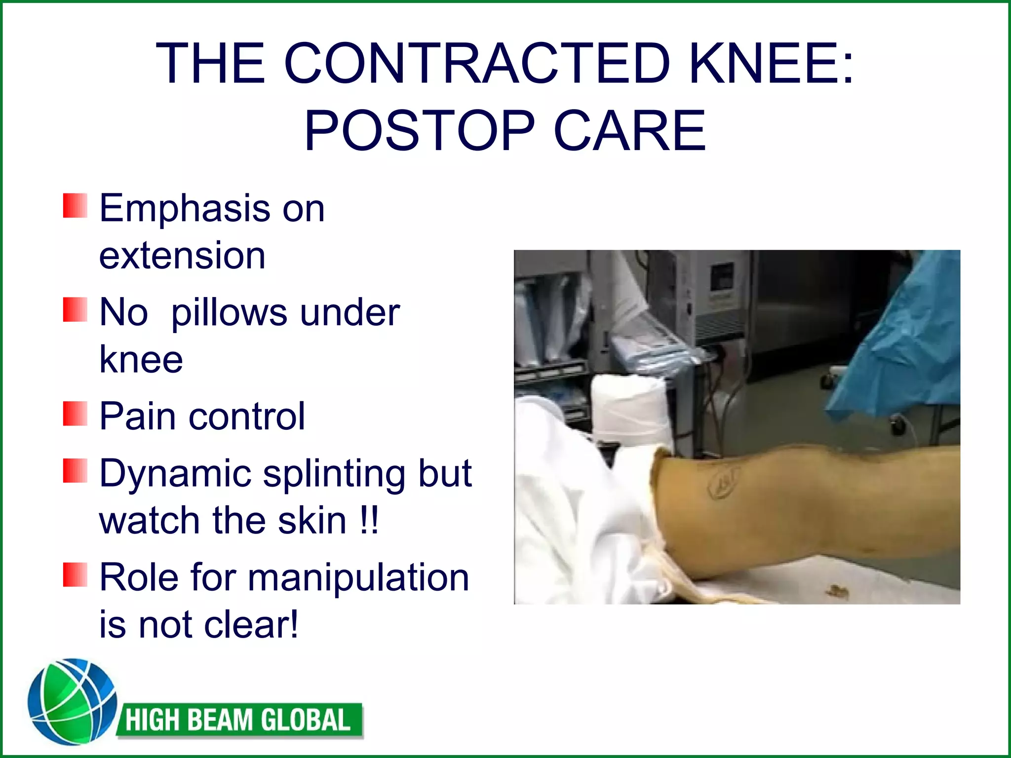 Techniques in primary total knee arthroplasty | PPT