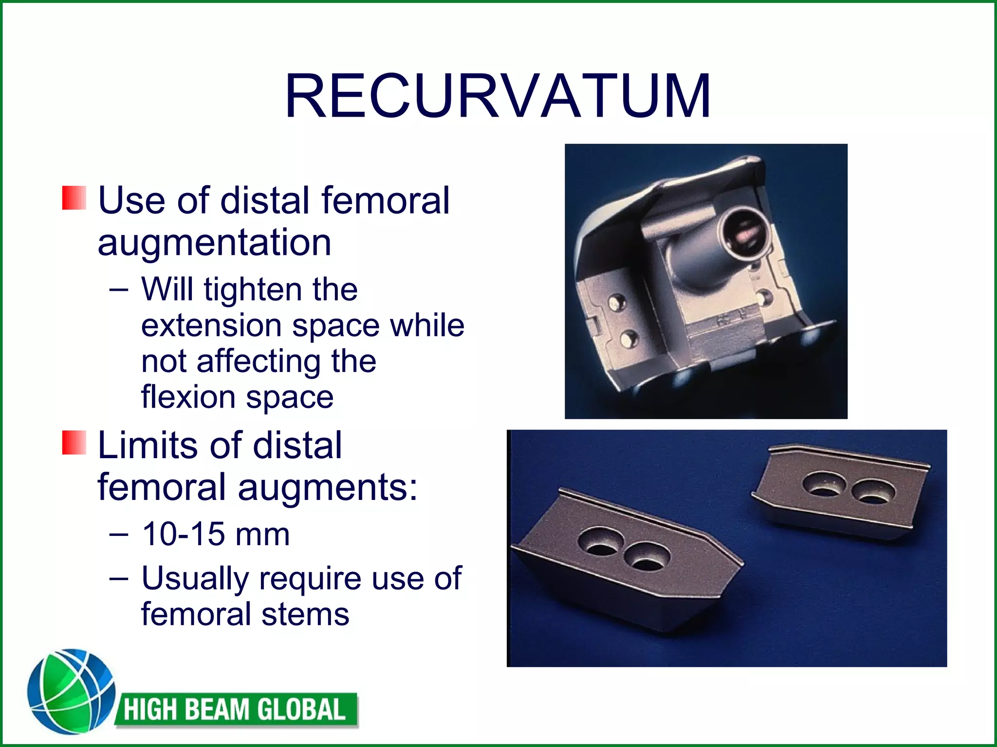 Techniques in primary total knee arthroplasty | PPT