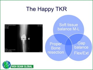 Techniques in primary total knee arthroplasty | PPT