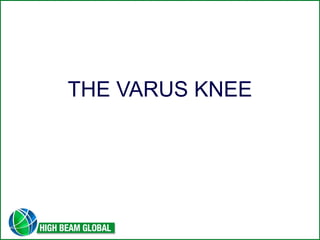 Techniques in primary total knee arthroplasty | PPT