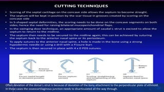 Techniques in septoplasty.pptx