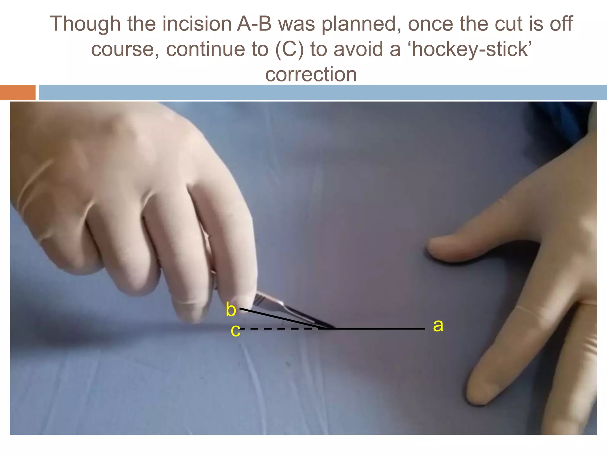 Techniques in the use of surgical tools | PPTX