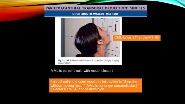X ray of technique sinuses | PPT