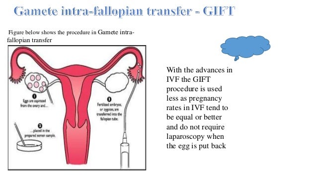 Techniques involved in assisted reproductive technology