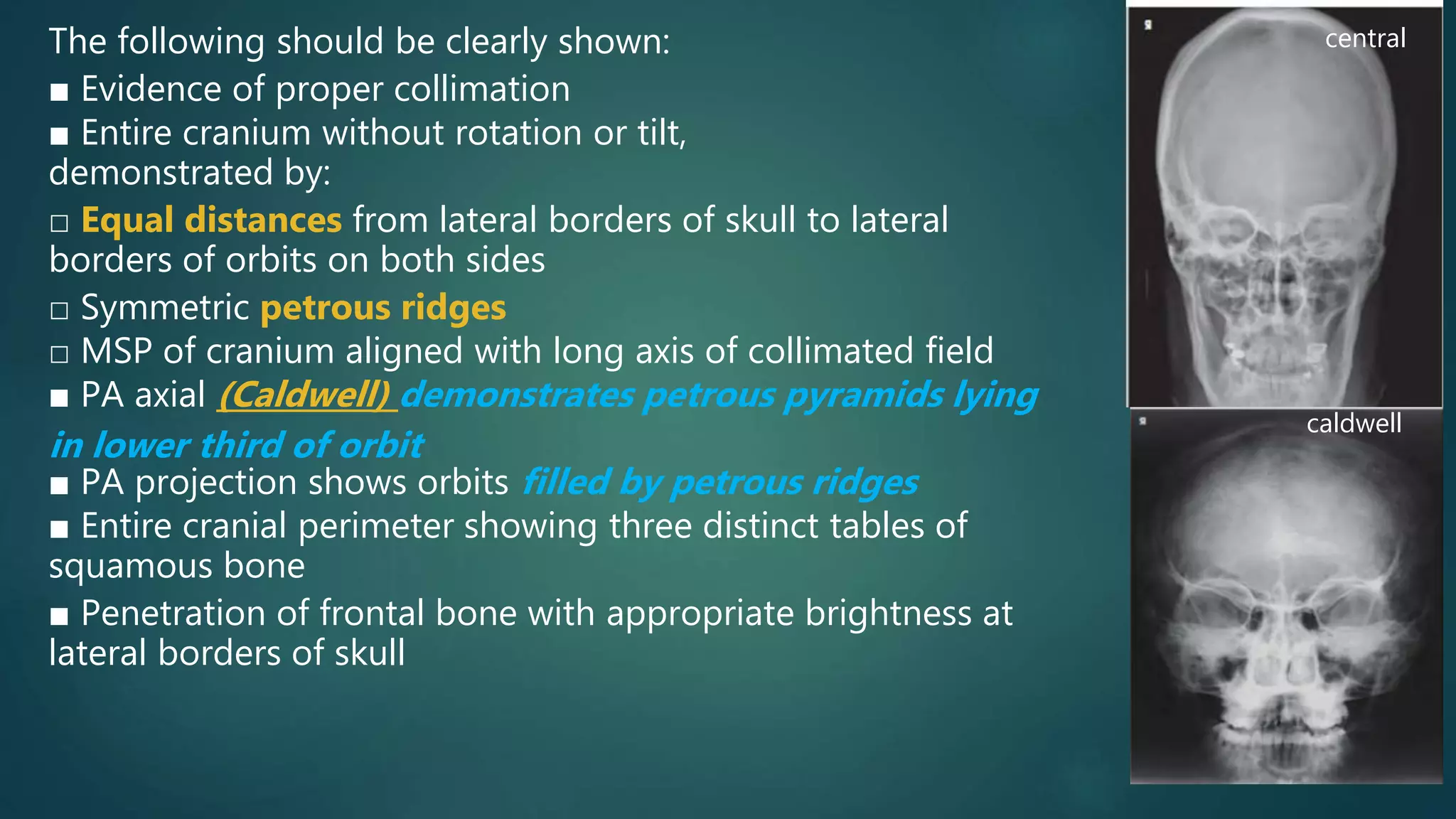 Technique skull x ray | PPTX