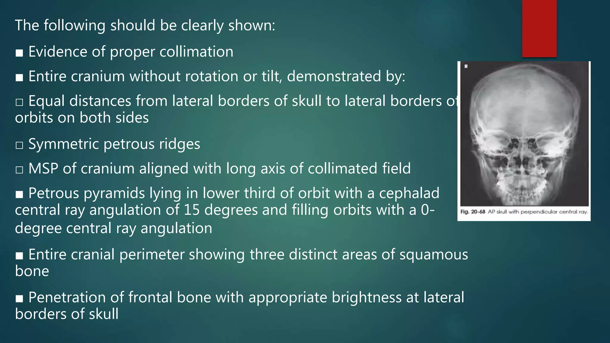 Technique skull x ray | PPTX