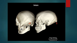 Technique skull x ray | PPTX