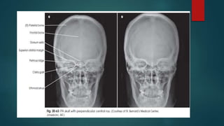 Technique skull x ray | PPTX
