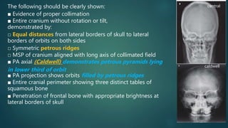 Technique skull x ray | PPTX