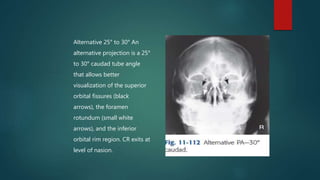 Technique skull x ray | PPTX