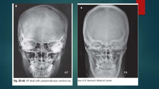 Technique skull x ray | PPTX