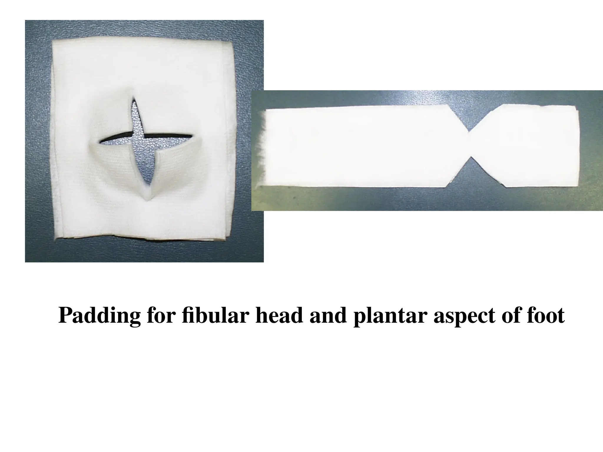 techniques of cast application and cast complications.pptx