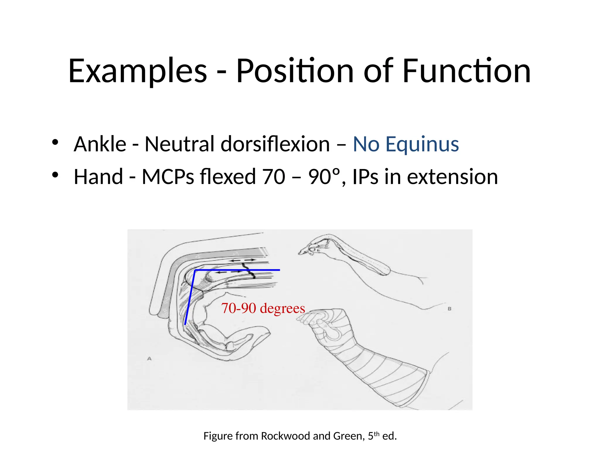 techniques of cast application and cast complications.pptx