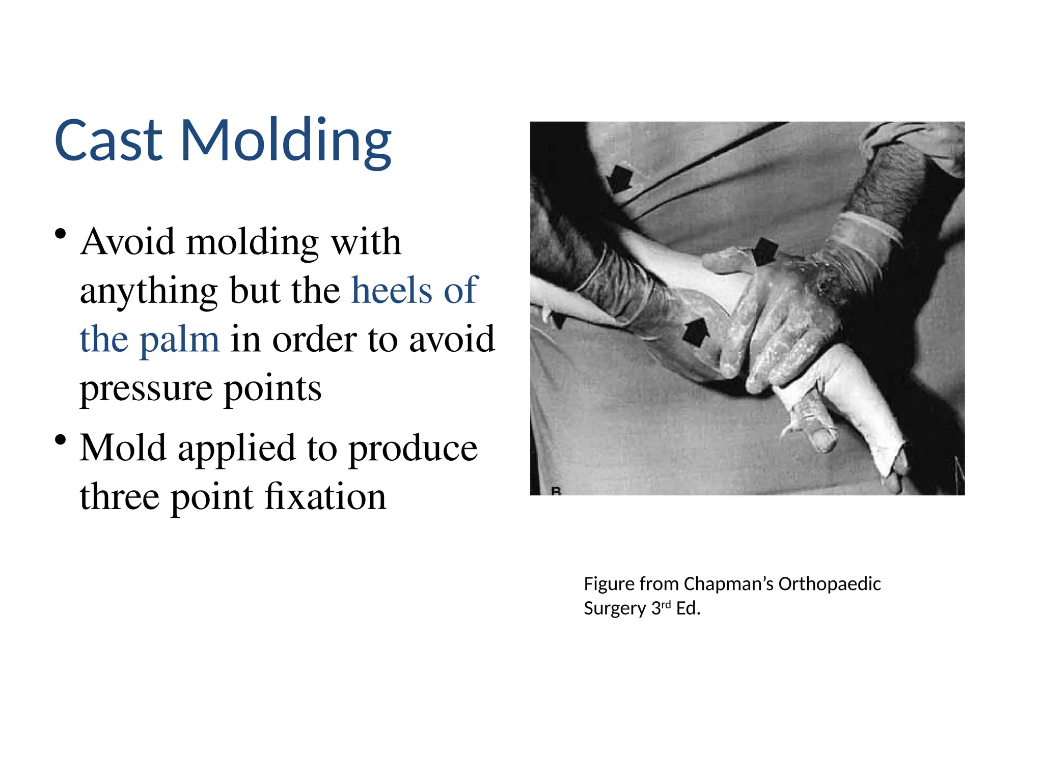 techniques of cast application and cast complications.pptx
