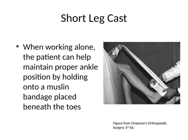 techniques of cast application and cast complications.pptx