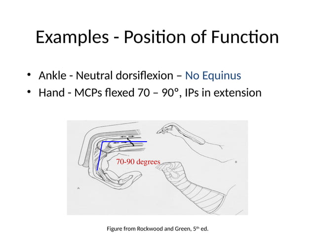 techniques of cast application and cast complications.pptx