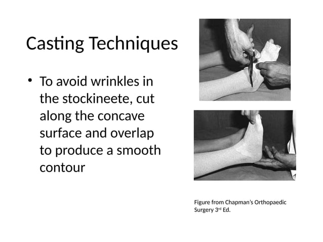 techniques of cast application and cast complications.pptx