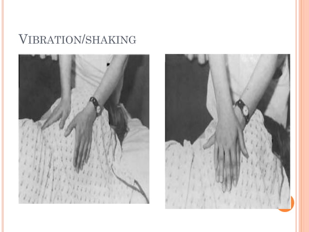 Techniques of chest physiotherapy | PPTX