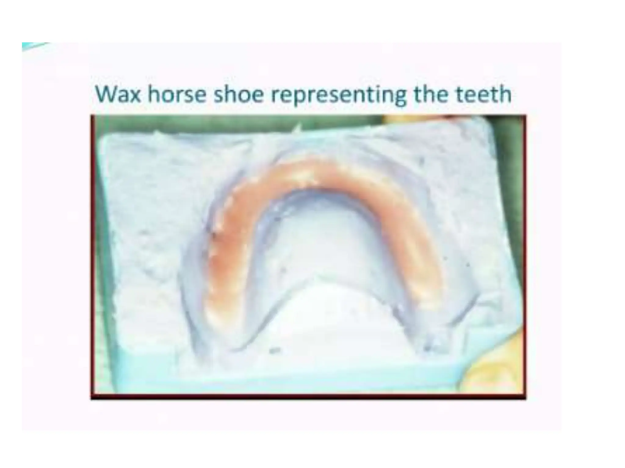 Techniques of copy denture fabrication.pptx
