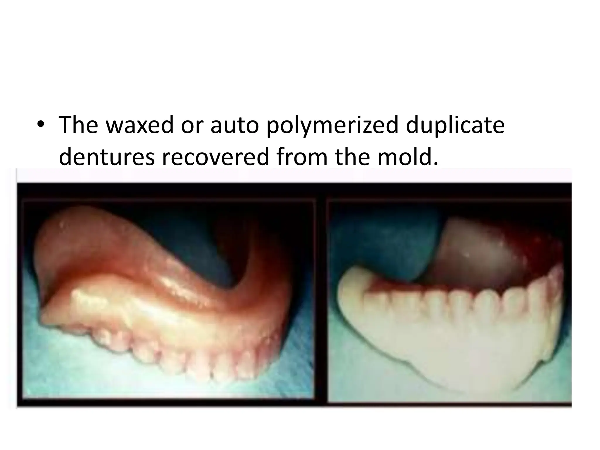 Techniques of copy denture fabrication.pptx