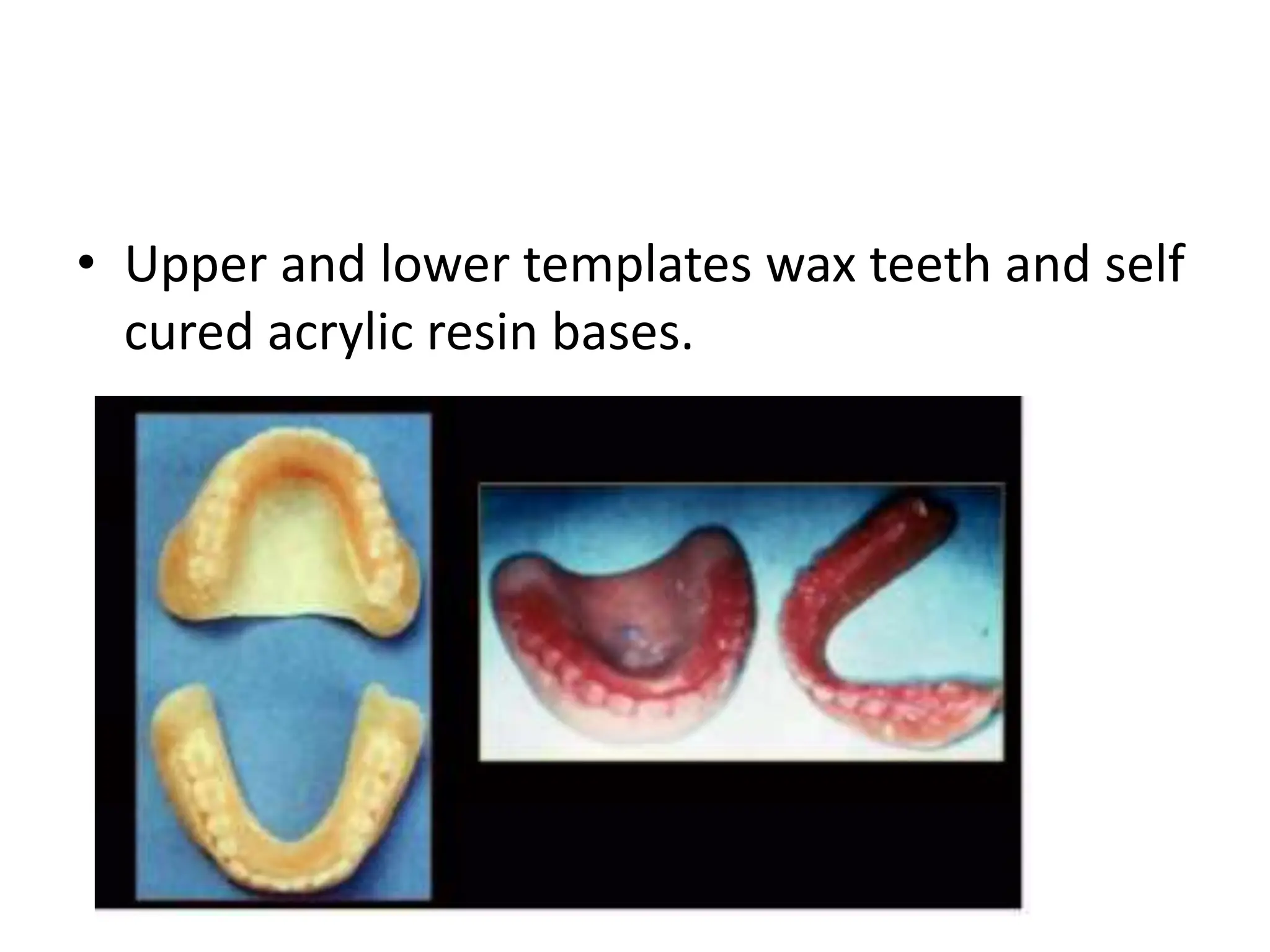 Techniques of copy denture fabrication.pptx