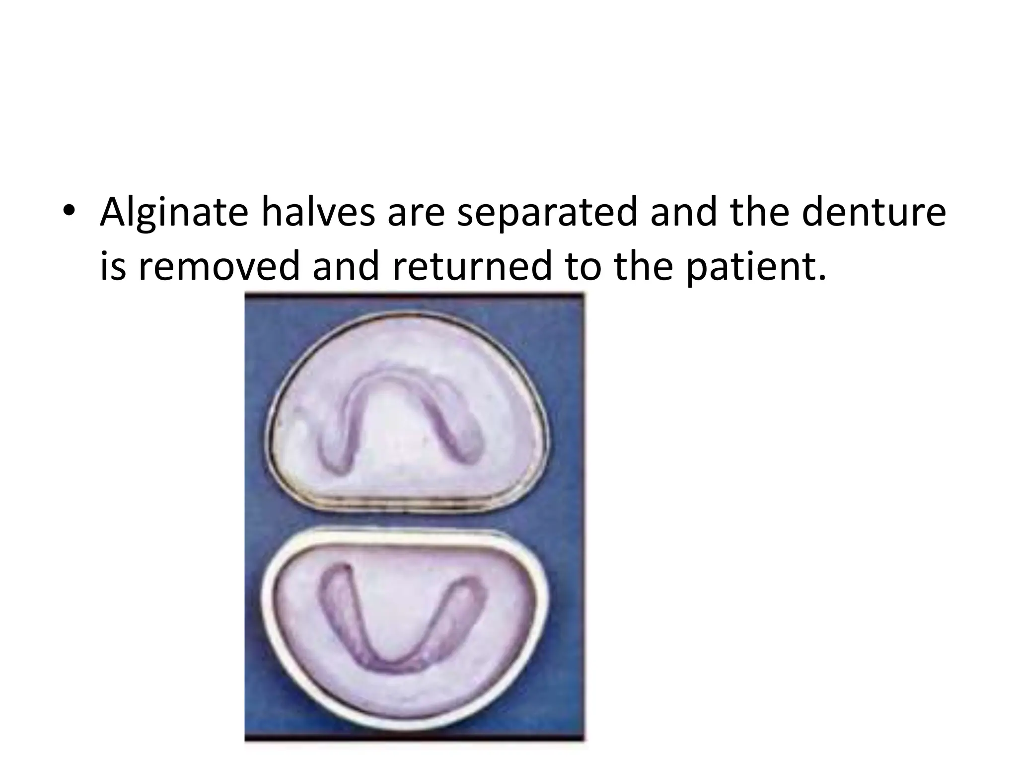 Techniques of copy denture fabrication.pptx