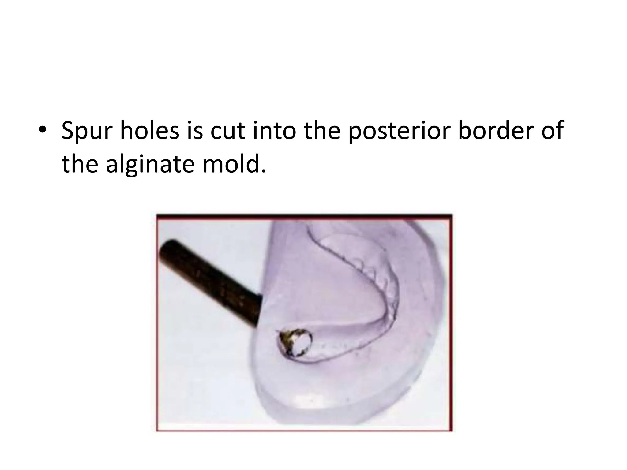 Techniques of copy denture fabrication.pptx