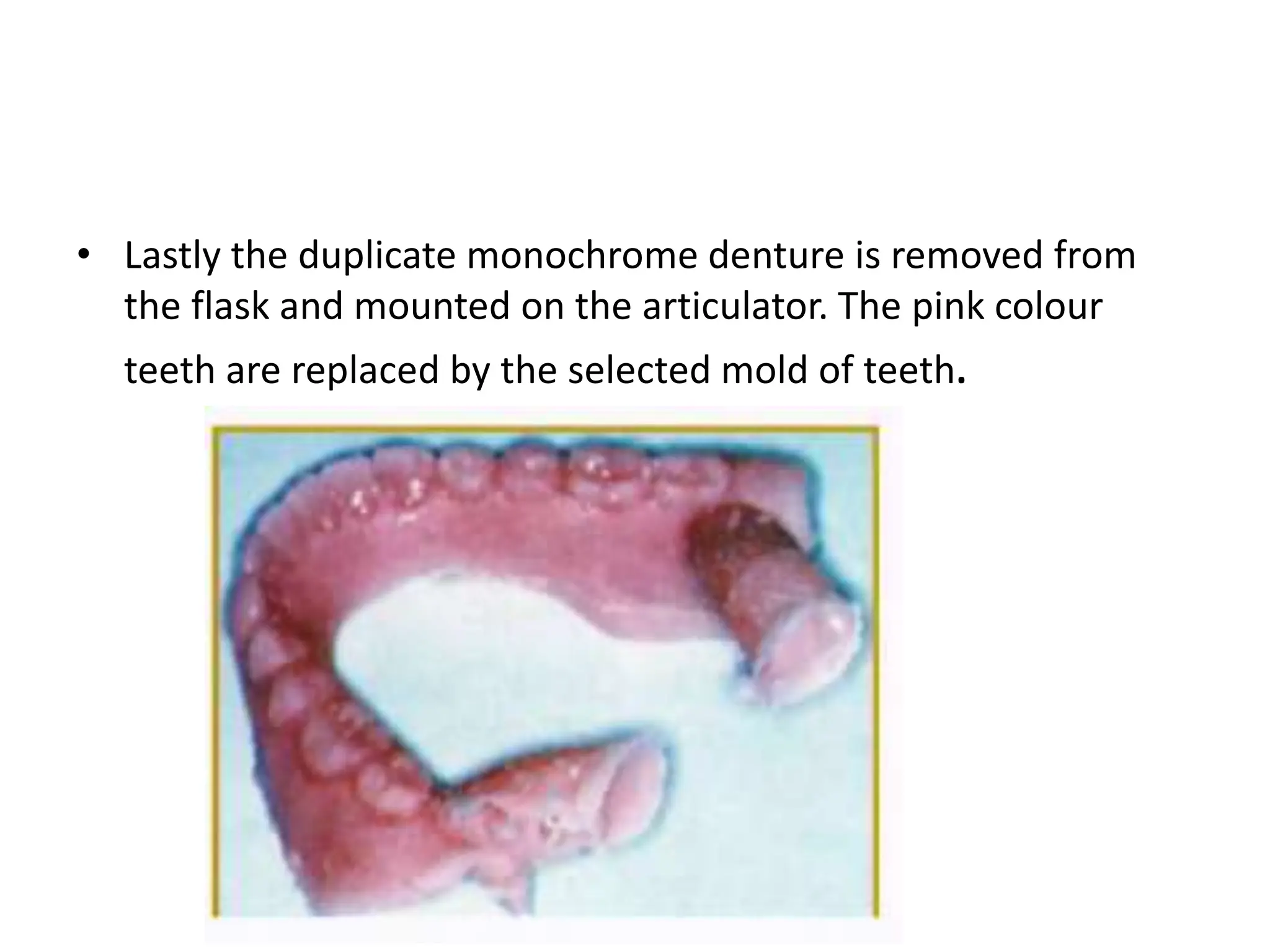 Techniques of copy denture fabrication.pptx