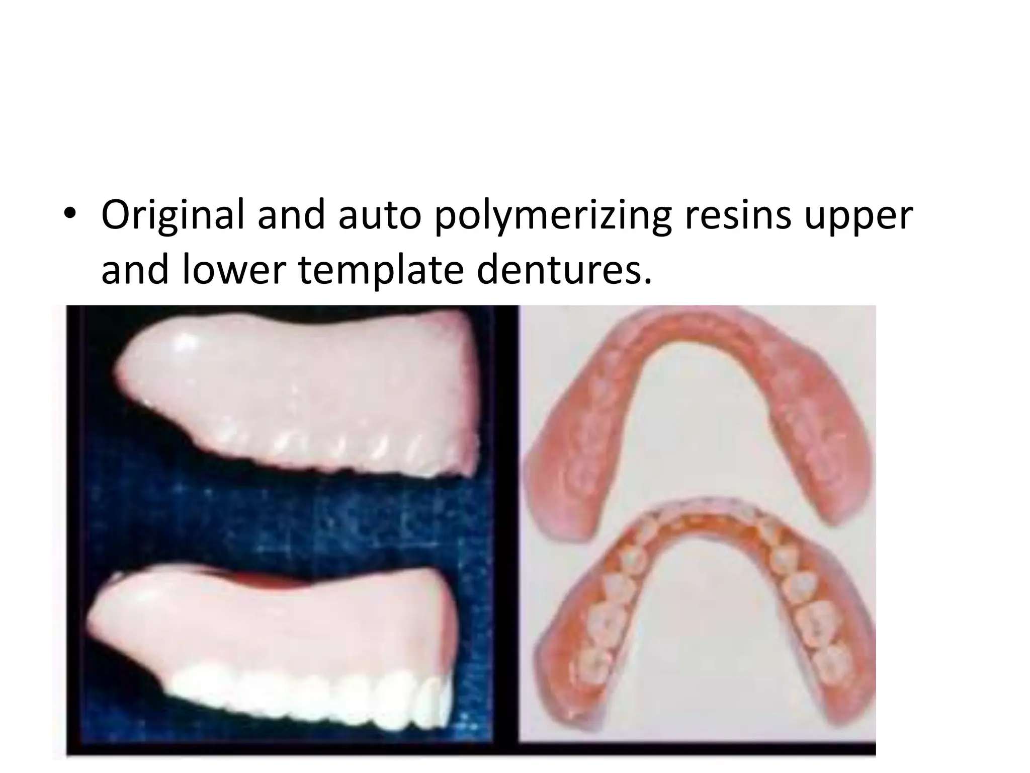 Techniques of copy denture fabrication.pptx