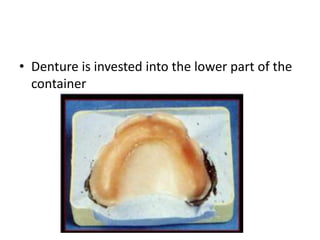 Techniques of copy denture fabrication.pptx