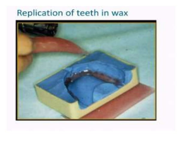 Techniques of copy denture fabrication.pptx