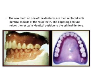 Techniques of copy denture fabrication.pptx