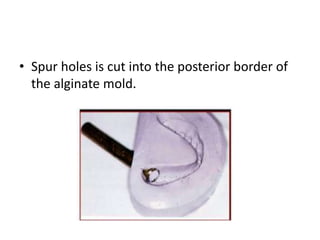 Techniques of copy denture fabrication.pptx