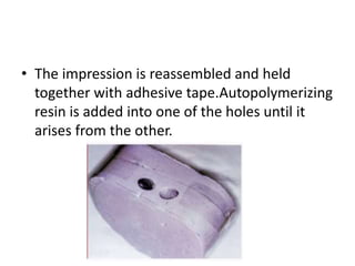 Techniques of copy denture fabrication.pptx