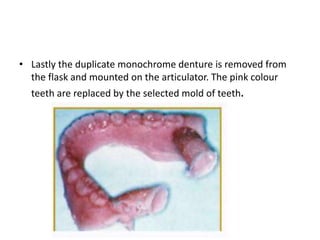 Techniques of copy denture fabrication.pptx