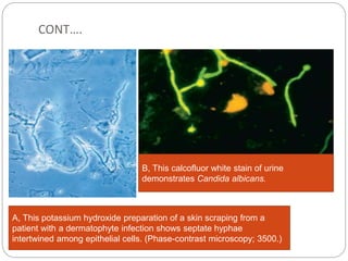 Techniques of diagnostic Mycology- 5 hours | PPTX