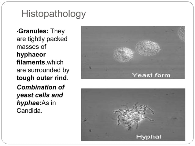 Techniques of diagnostic Mycology- 5 hours | PPTX | Skin and ...