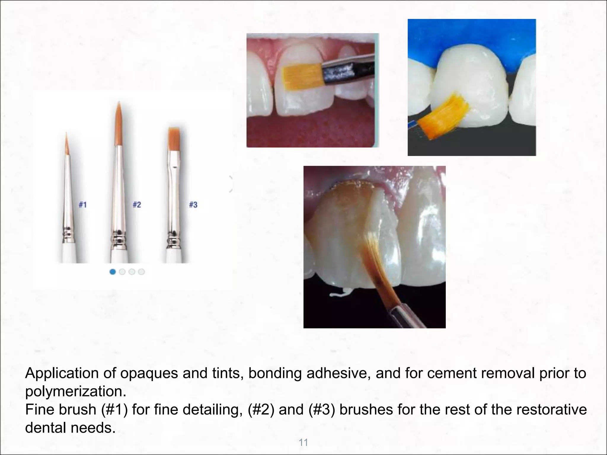 Techniques of direct composite restoration | PPT
