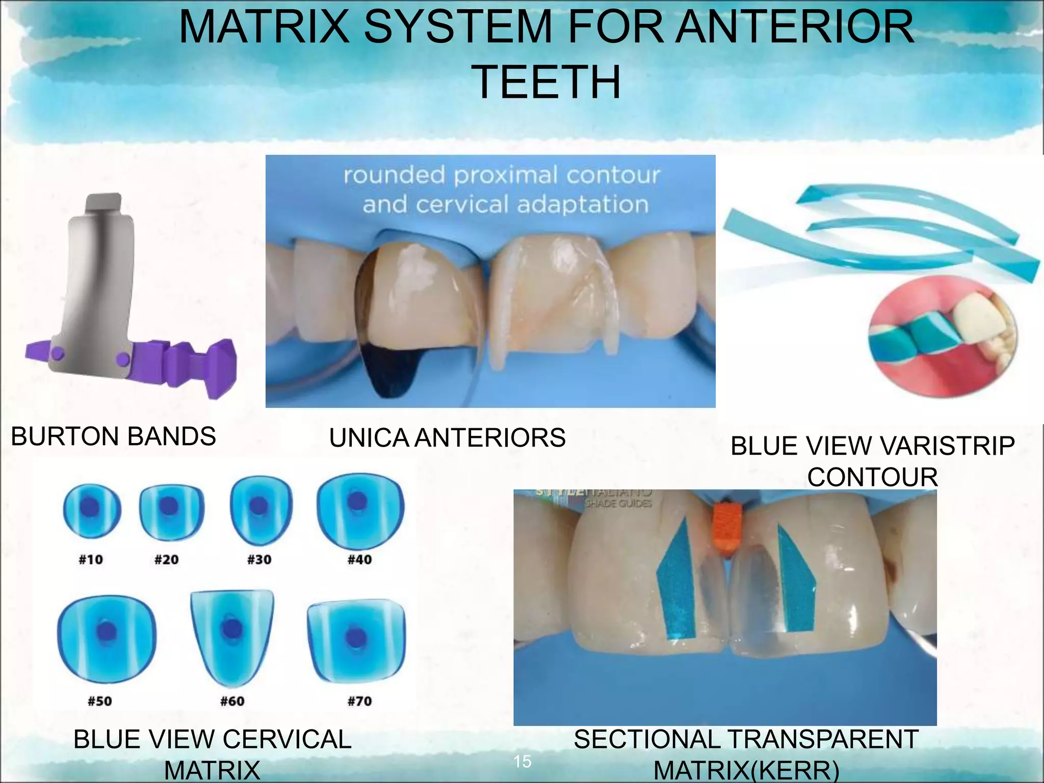 Techniques of direct composite restoration | PPT